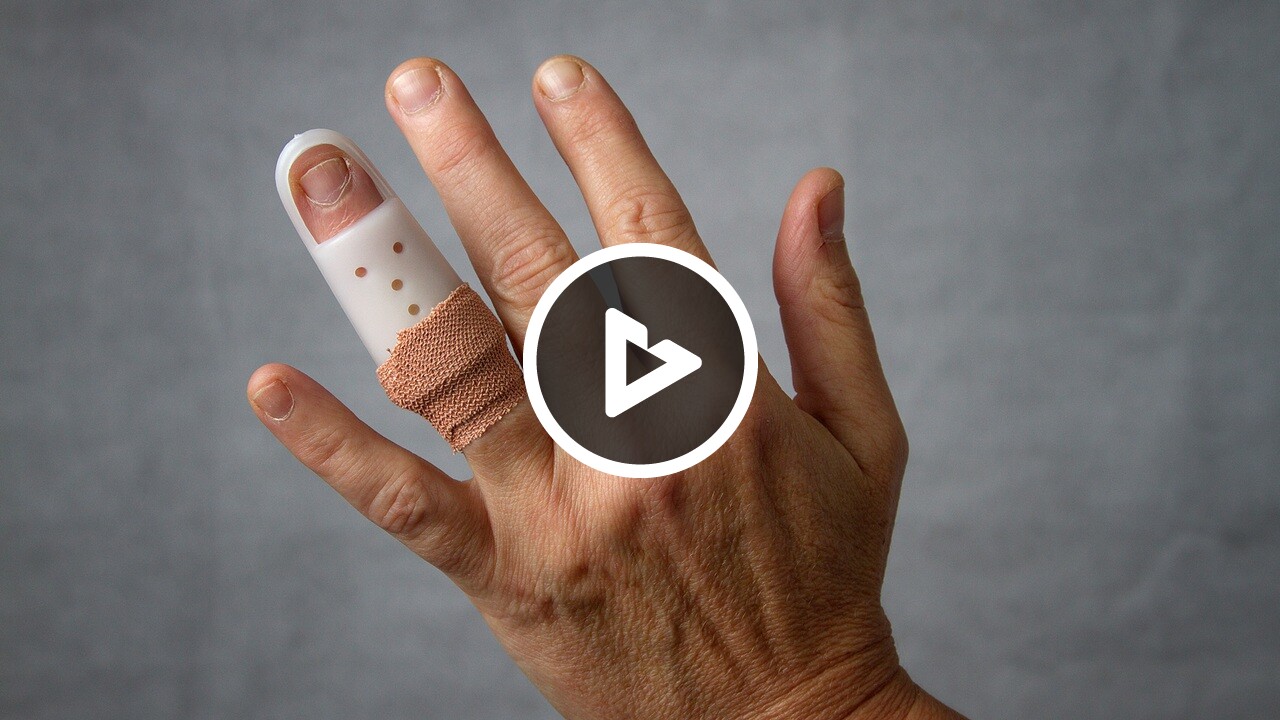 Finger Fracture - Upper Extremity (Arms and Hands) - Willis Knighton ...