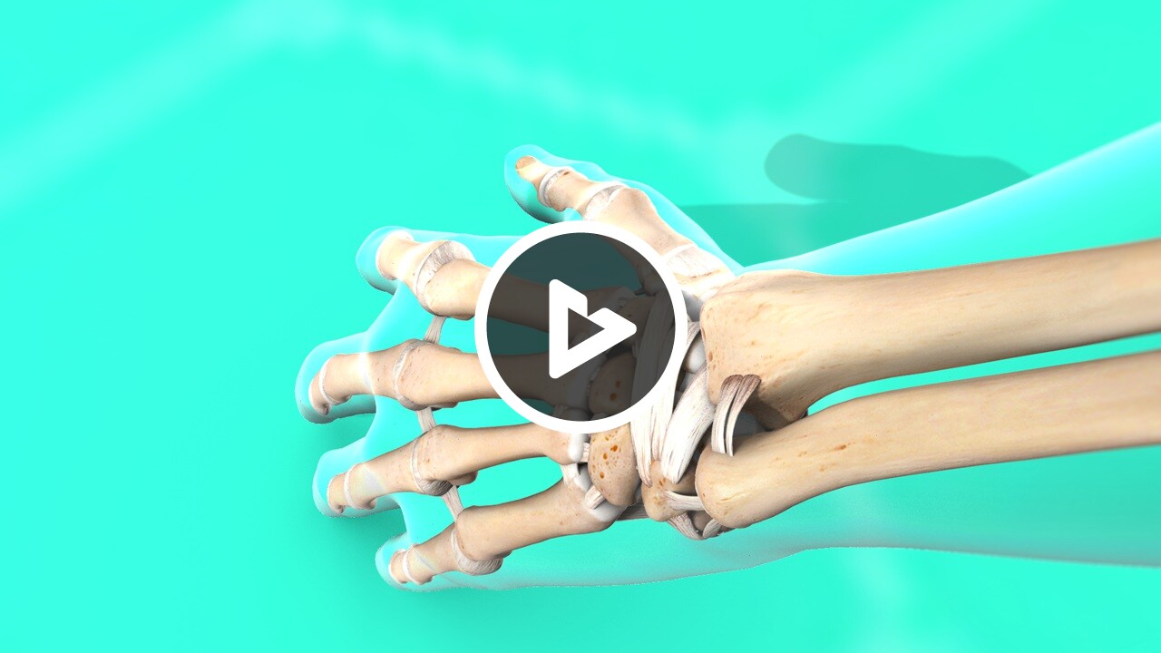 Wrist Sprain - Wrist - Willis Knighton Orthopedics Bossier - Bossier ...